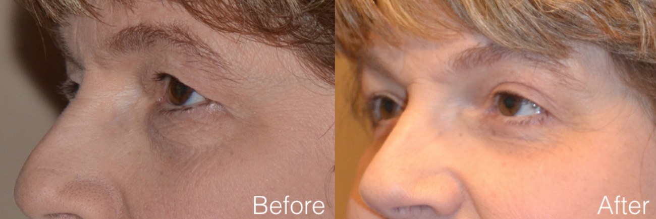 Client Results - Envision Eye Surgery